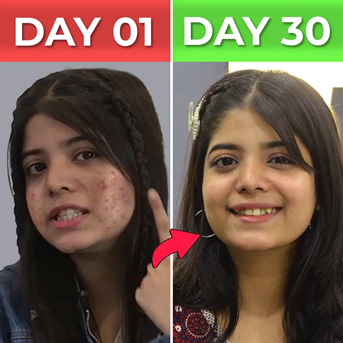 Pe Before And After